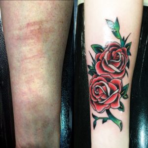 30 Best Tattoos That Cover Birthmarks
